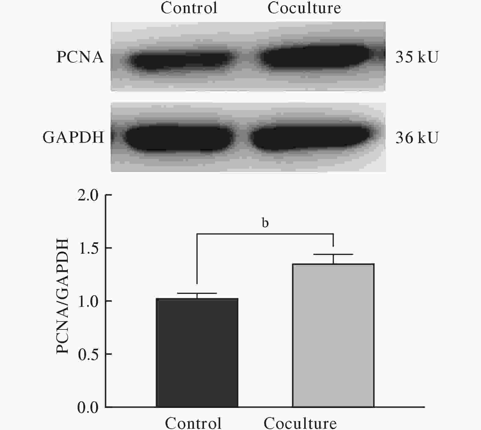 Transwell小室共培养条件下微血管内皮细胞对成骨细胞增殖、凋亡的影响
