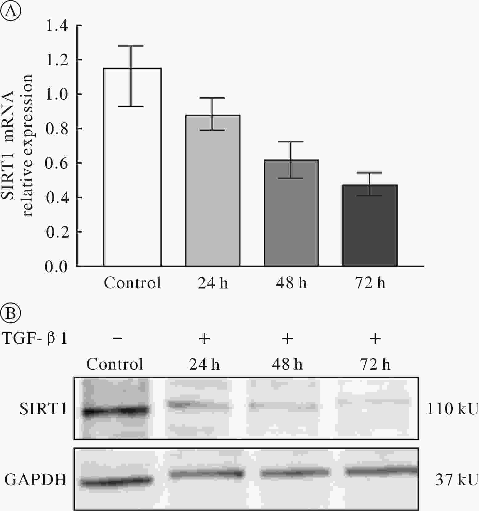 组蛋白去乙酰化酶1在慢性鼻窦炎上皮细胞中的表达及其对鼻黏膜上皮间质转化的影响