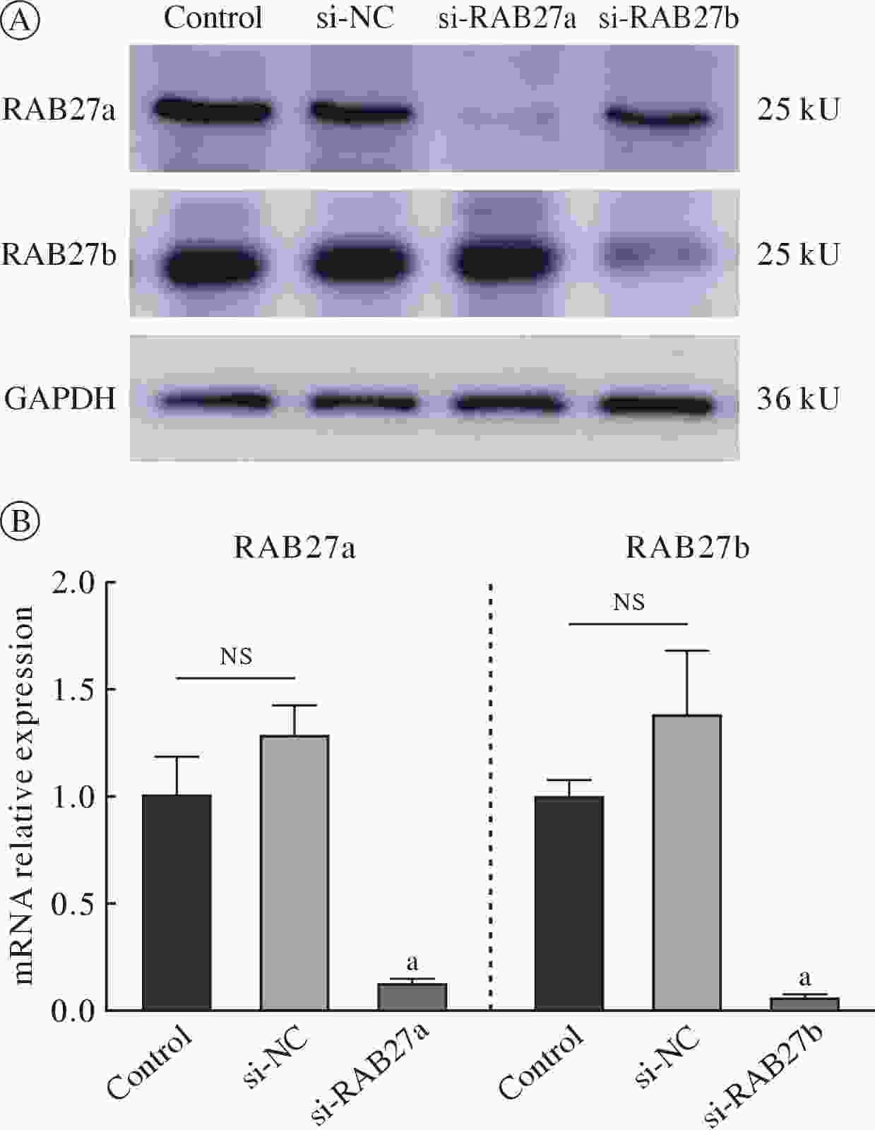 探讨Rab27蛋白家族在三阴性乳腺癌细胞耐药机制中的作用