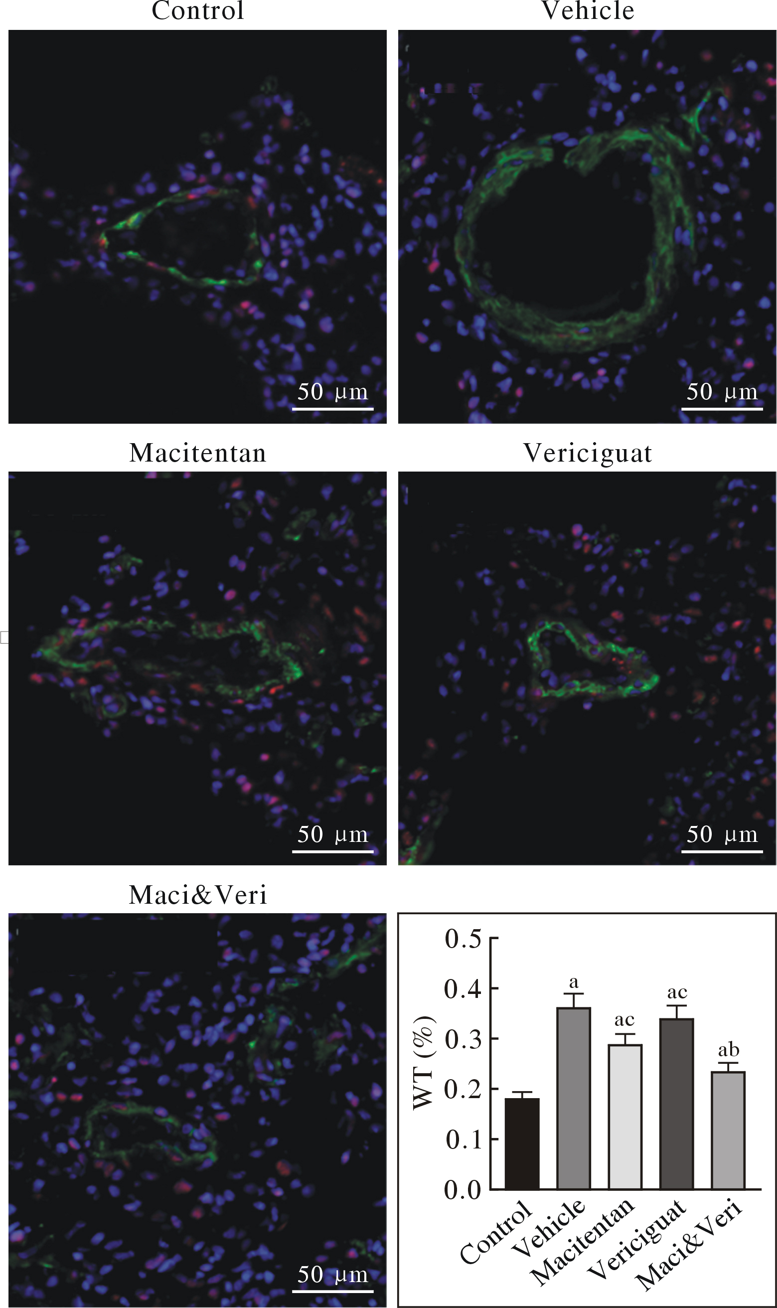 Mechanisms of combination of macitentan and vericiguat in the treatment ...