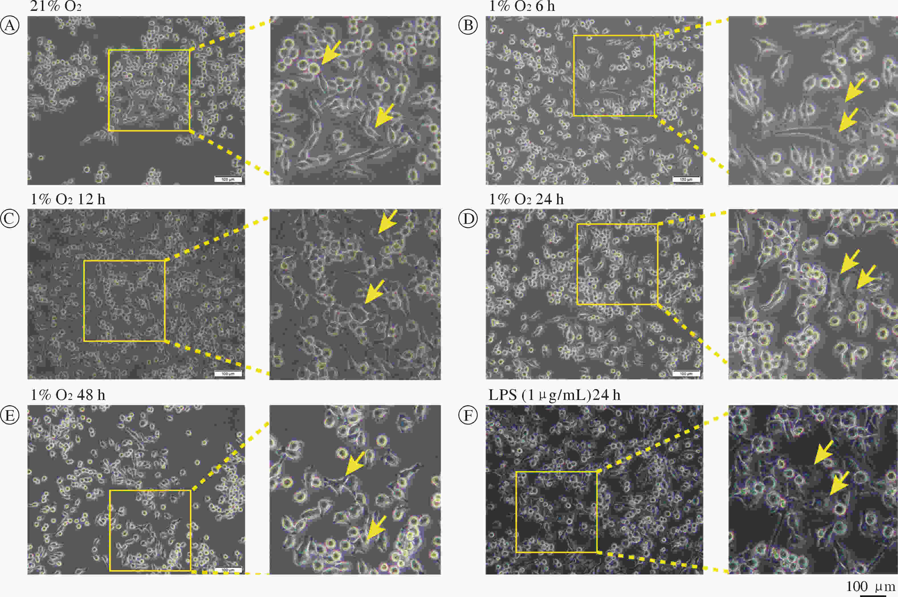 NLRX1对低氧诱导的小胶质细胞极化的影响