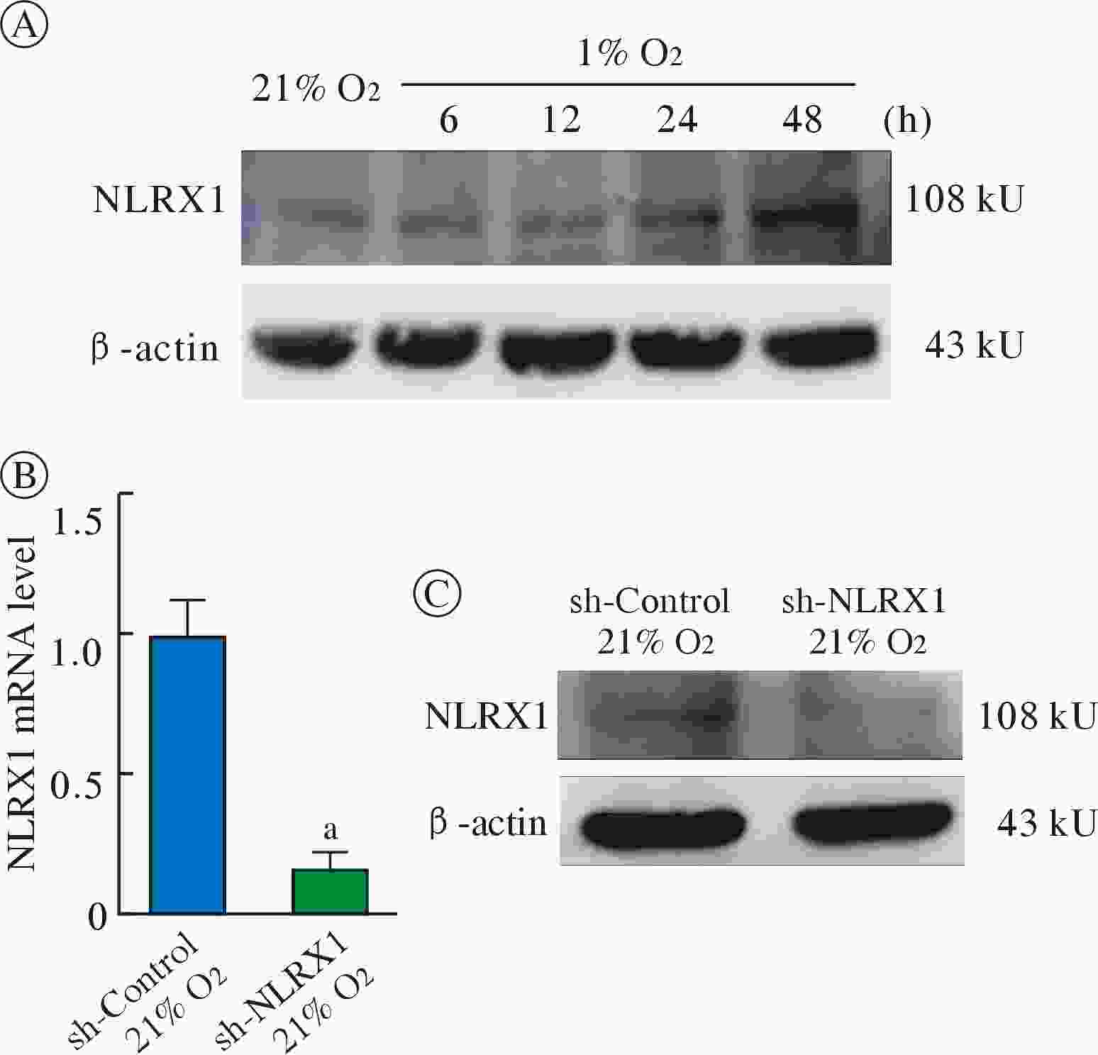NLRX1对低氧诱导的小胶质细胞极化的影响