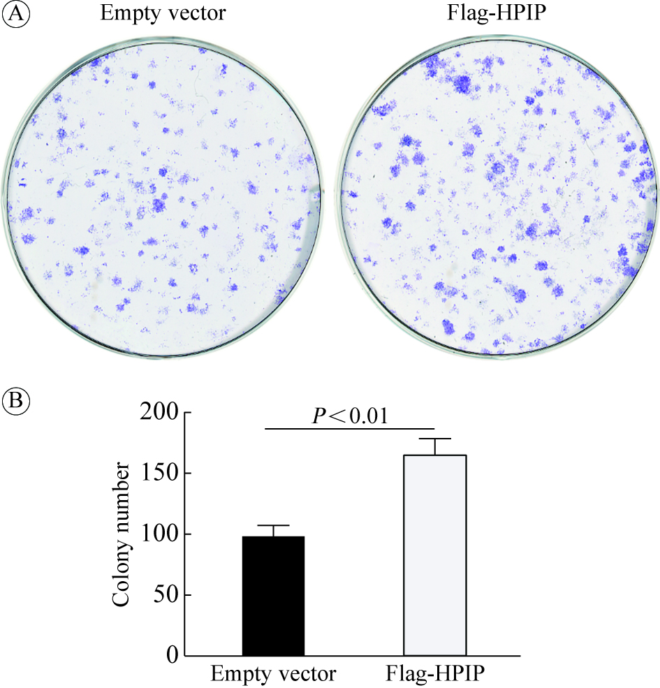人HPIP基因真核表达载体的构建及其对肺癌细胞的生物学影响