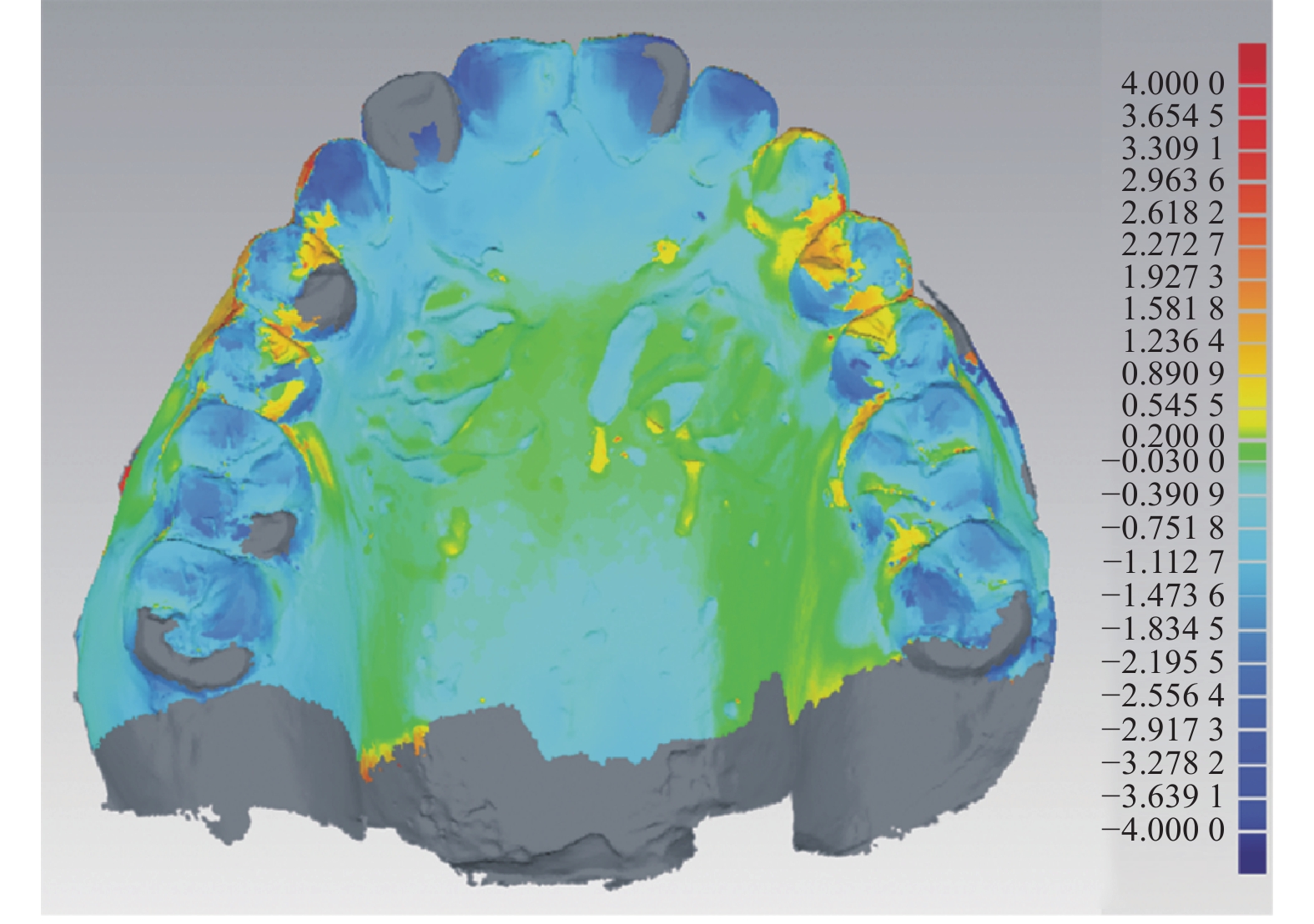 微种植支抗分步远移上颌全牙列牙齿的三维研究