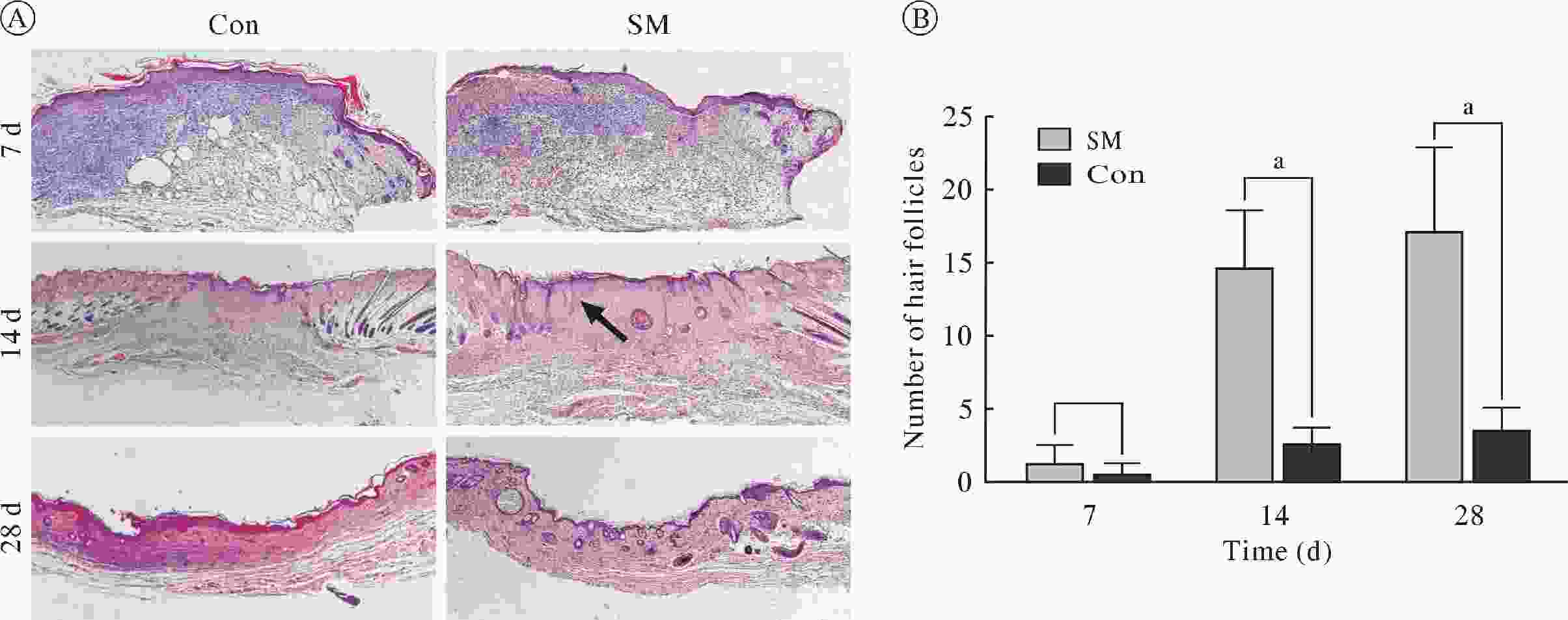 自制毛囊再生乳膏对小鼠皮肤创面毛囊再生的影响