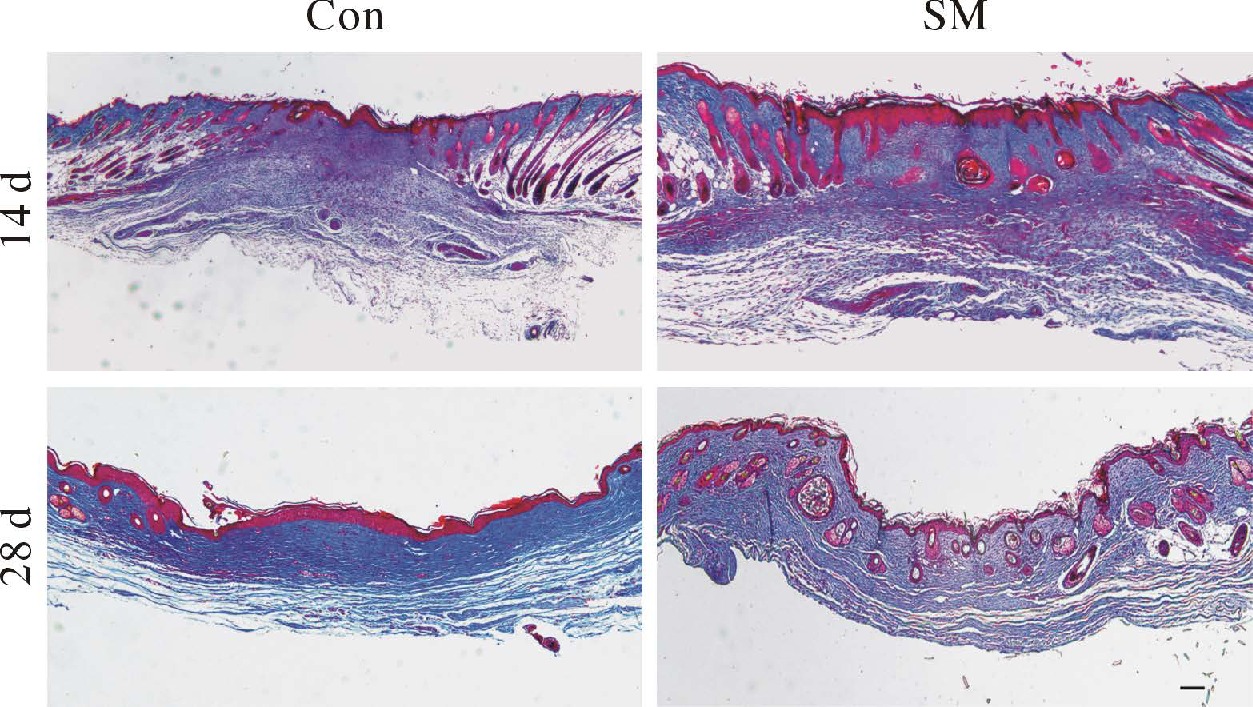 自制毛囊再生乳膏对小鼠皮肤创面毛囊再生的影响