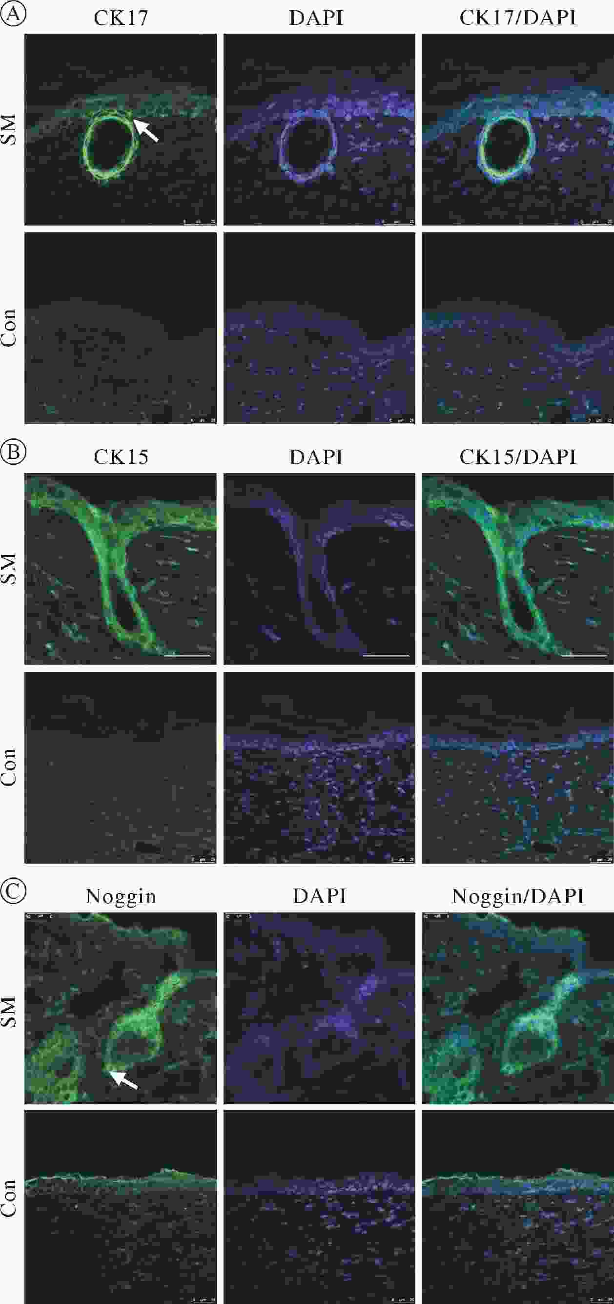 自制毛囊再生乳膏对小鼠皮肤创面毛囊再生的影响