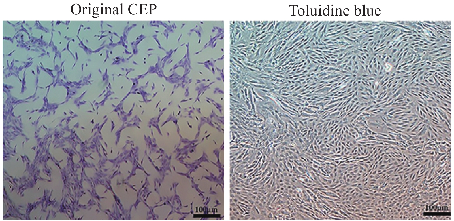 软骨终板干细胞及骨髓间充质干细胞对软骨终板细胞增殖分化的影响