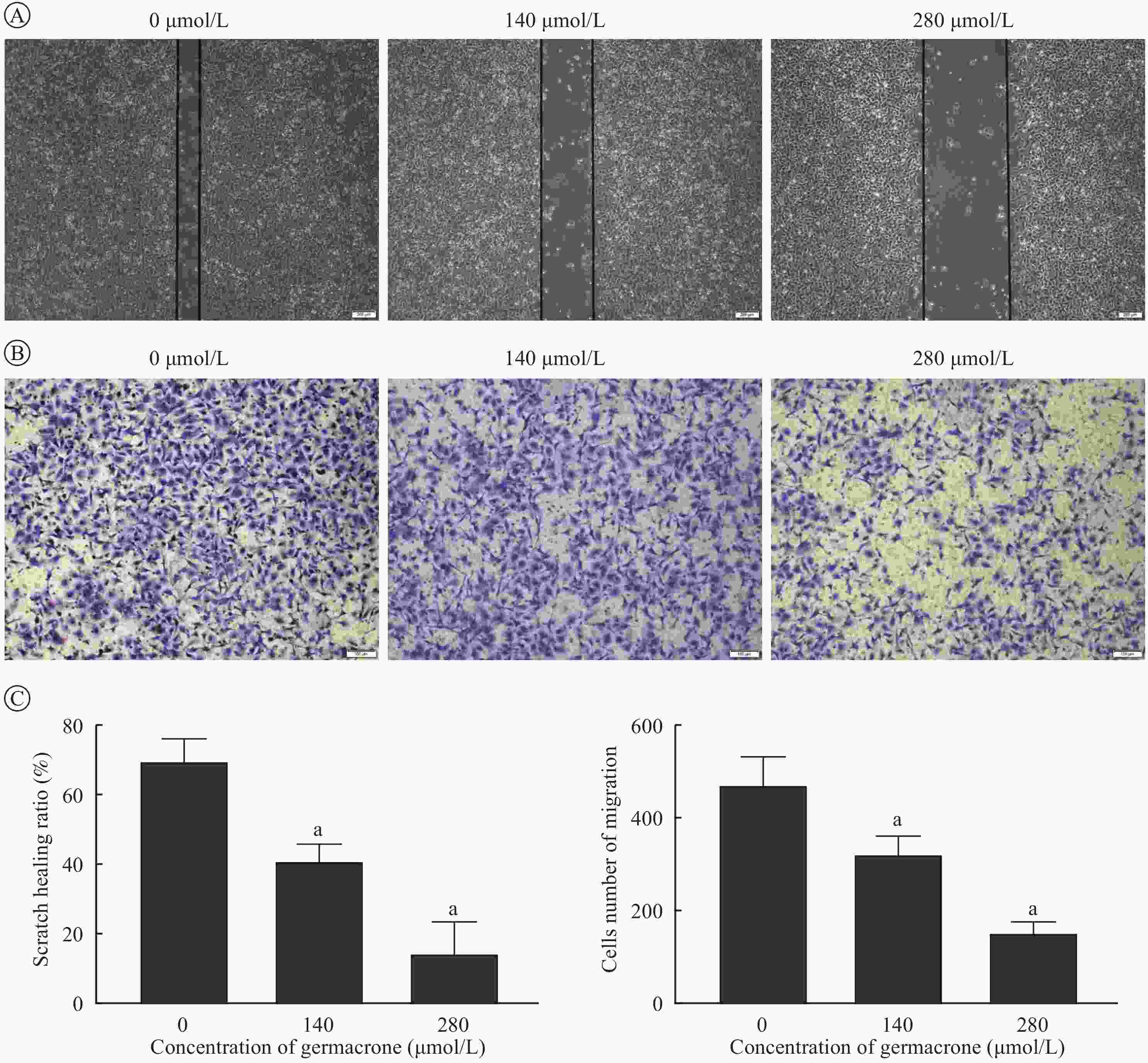 吉马酮调控JAK2/STAT3信号通路对卵巢癌SKOV3细胞增殖、迁移、侵袭的影响