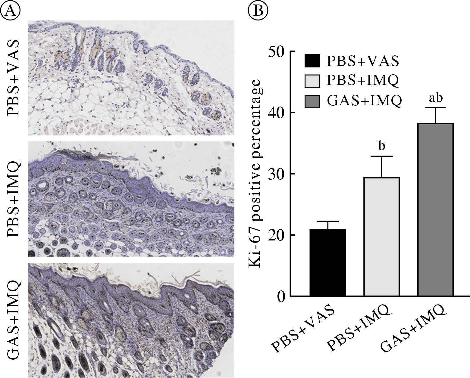 链球菌改进咪喹莫特诱导银屑病样皮炎动物模型的研究