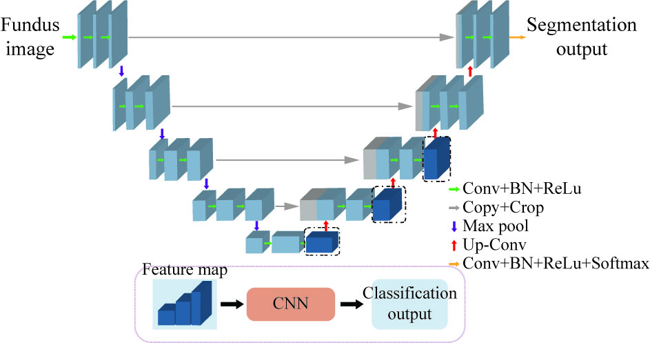 人工智能眼底分析技术对青光眼病灶的诊断价值研究