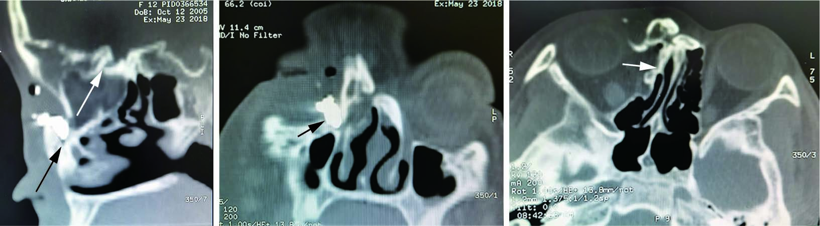 解放军医学院学报