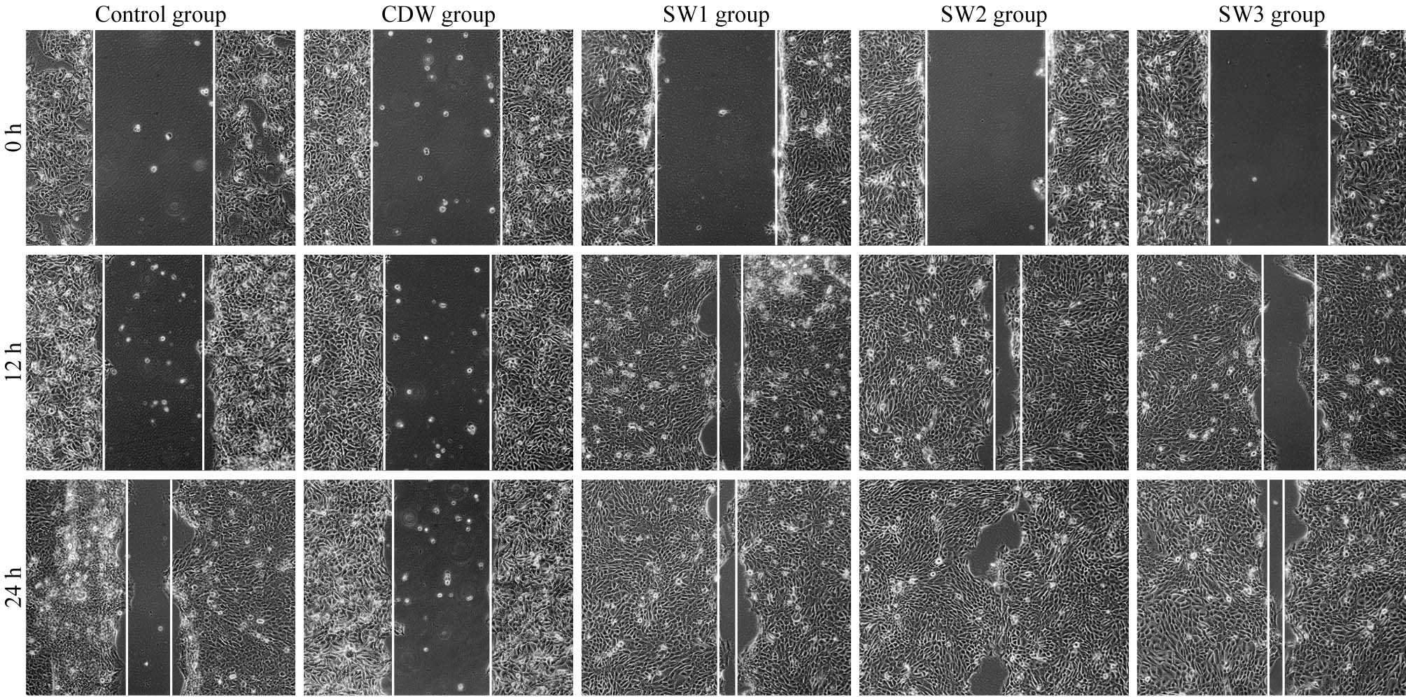 冲击波对糖尿病慢性创面微环境下HaCat细胞增殖及迁移的影响