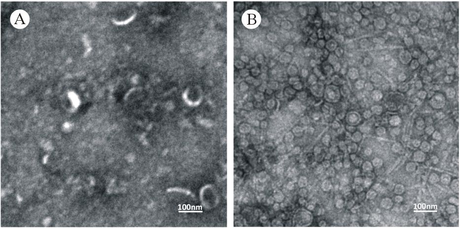 金葡菌和大肠埃希菌细菌外囊泡的生物学特性比较研究