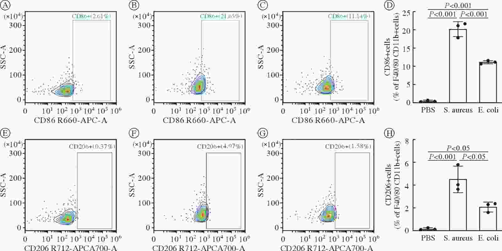金葡菌和大肠埃希菌细菌外囊泡的生物学特性比较研究