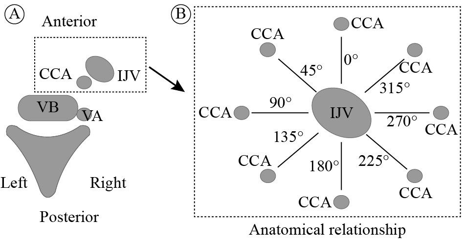 Anatomic relationship between internal jugular vein and common carotid ...