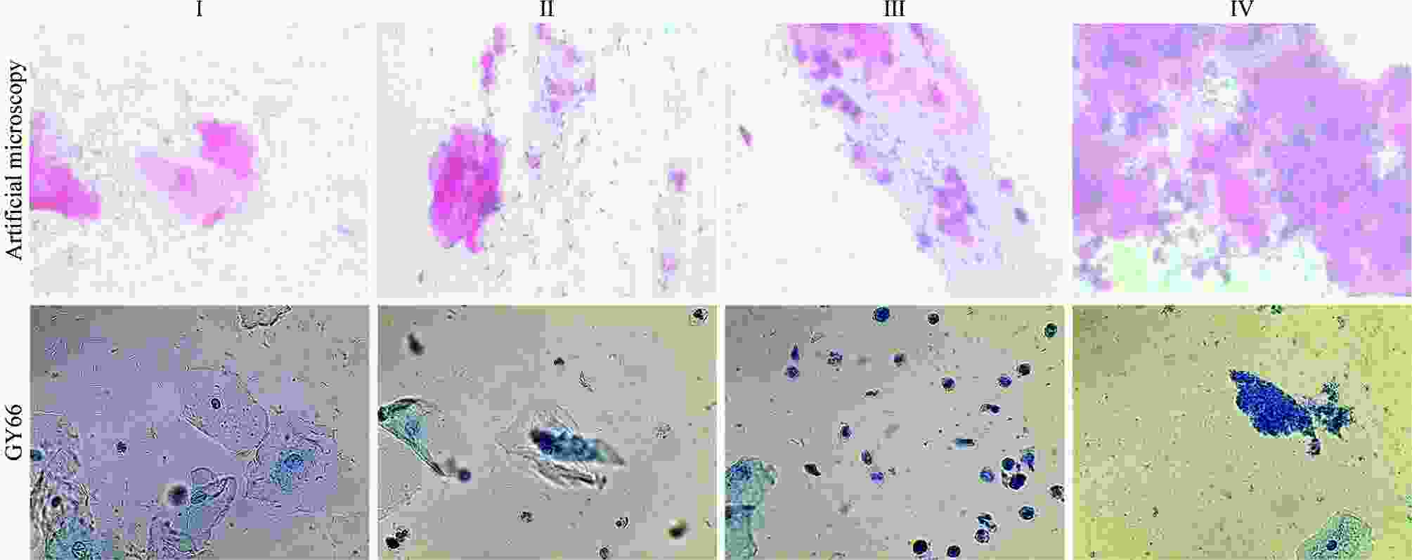 GY66阴道微生态形态学全自动检测仪临床应用评价