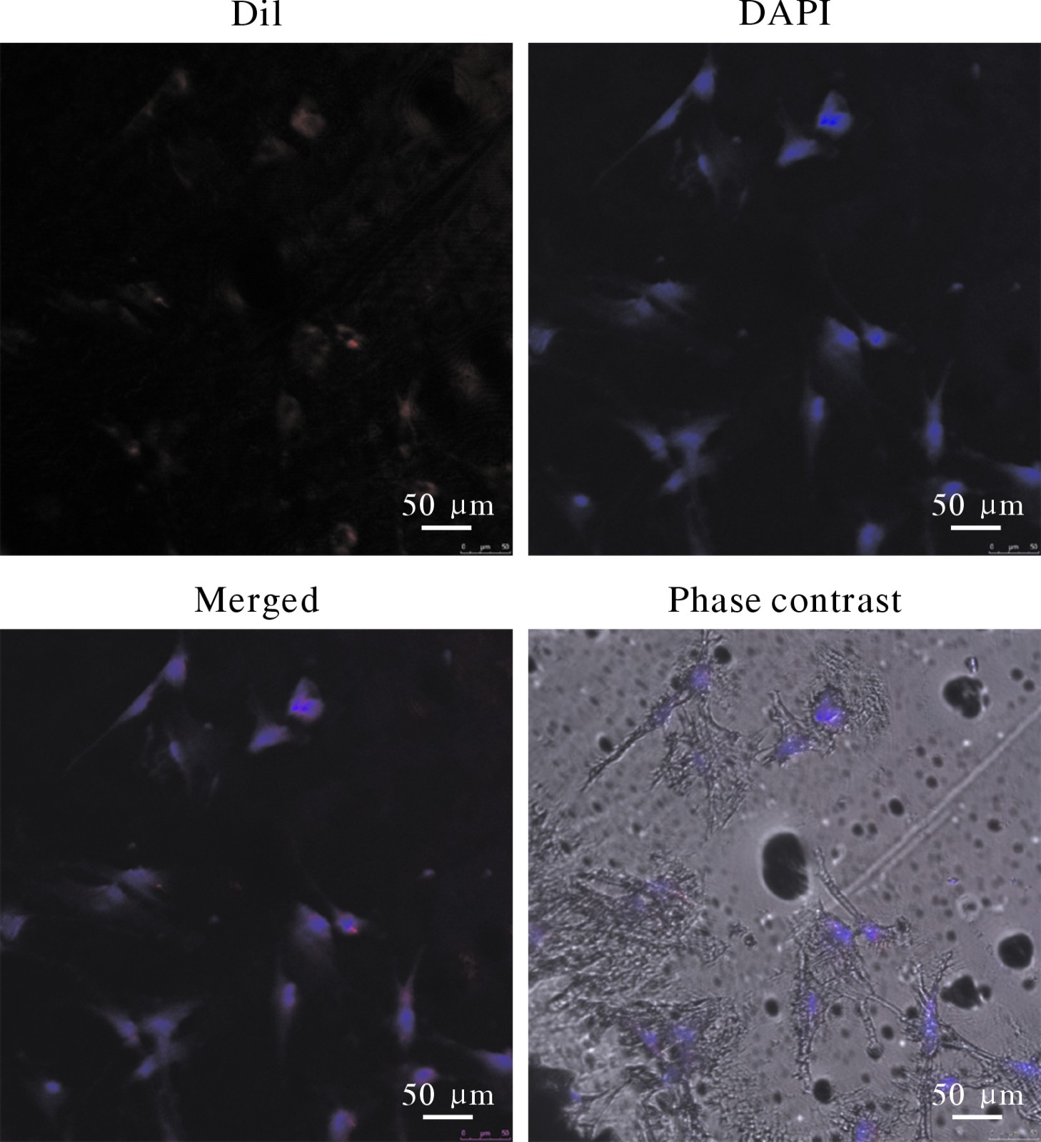 牙龈间充质干细胞来源外泌体对成骨样细胞MC3T3-E1体外增殖和成骨分化的影响