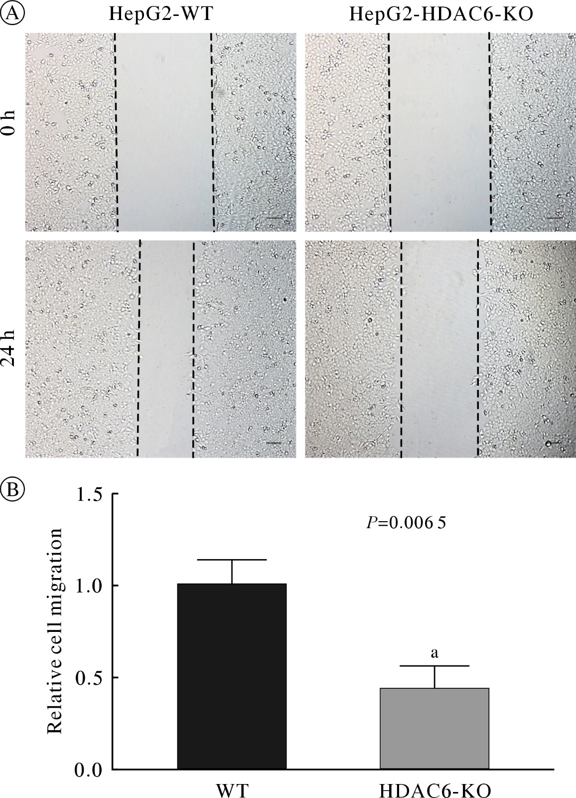 HDAC6基因敲除的人肝癌细胞系的构建及其生物学功能鉴定