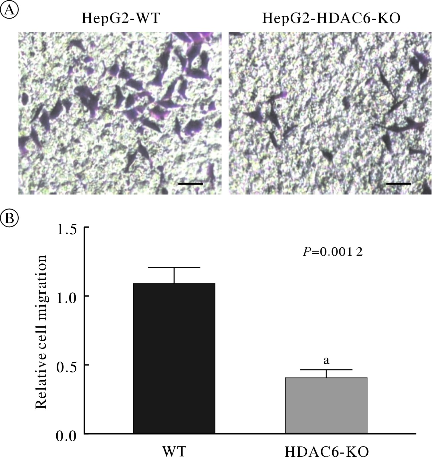 HDAC6基因敲除的人肝癌细胞系的构建及其生物学功能鉴定