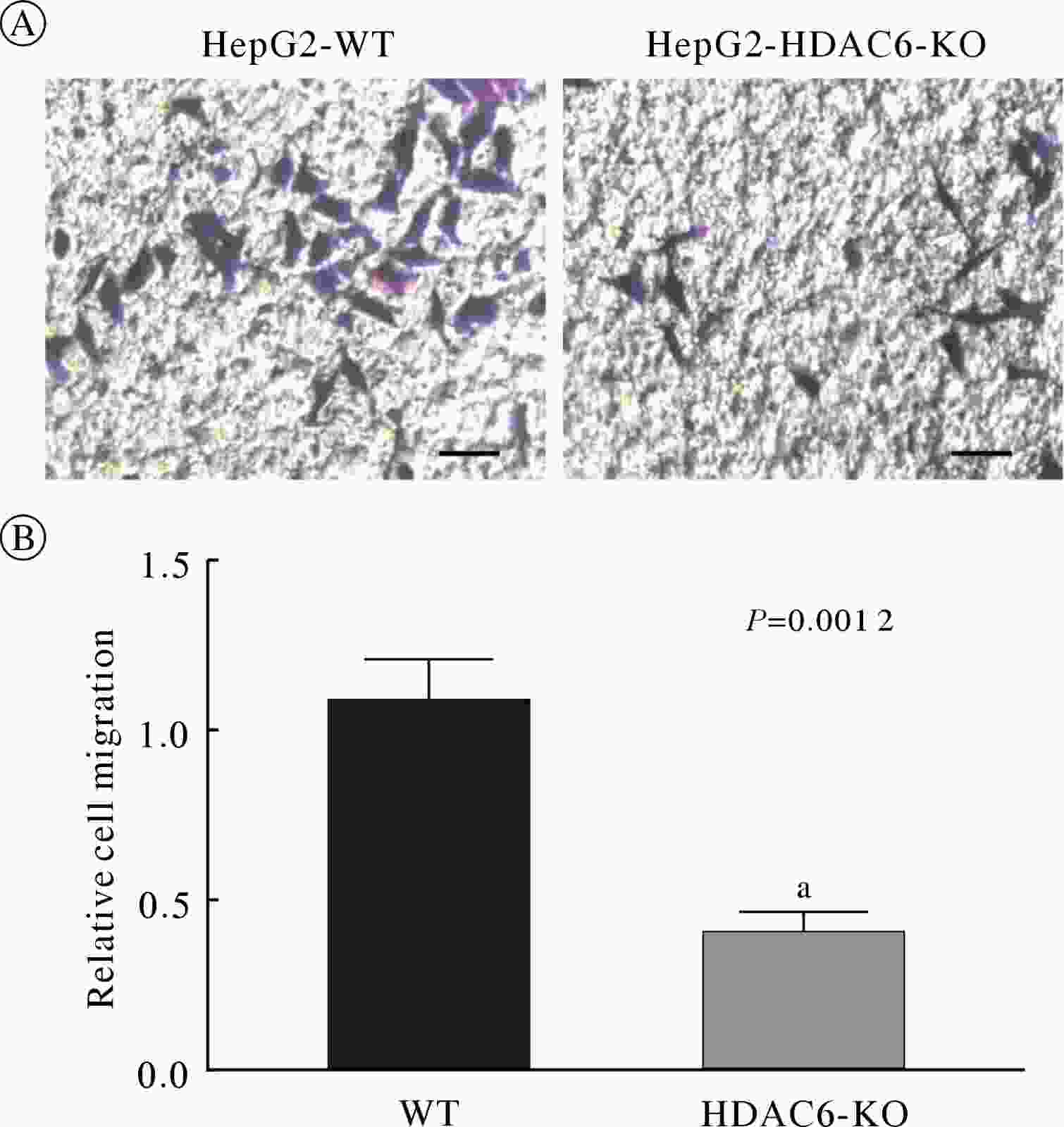HDAC6基因敲除的人肝癌细胞系的构建及其生物学功能鉴定