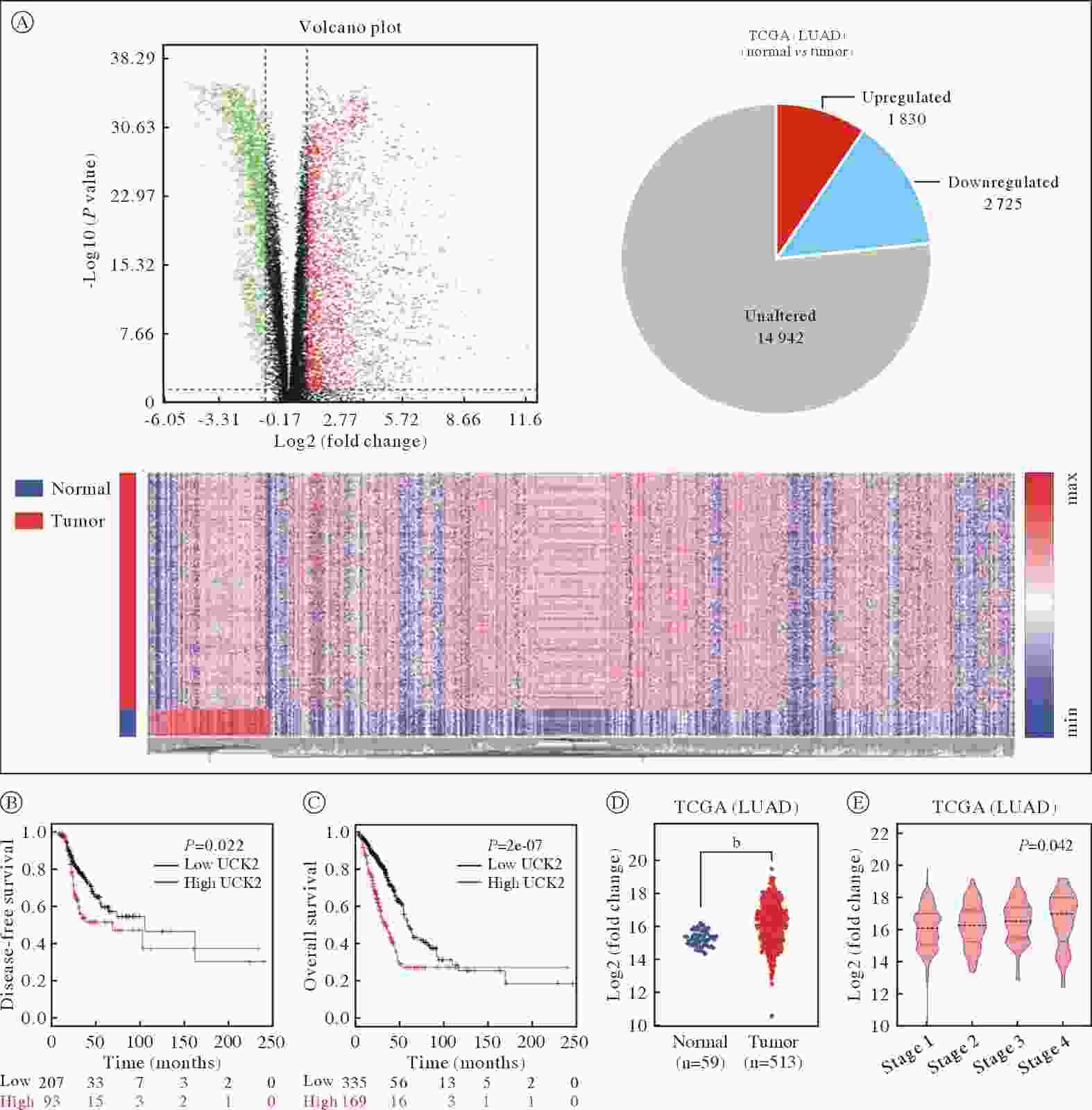 Mechanisms of UCK2 regulating growth of lung adenocarcinoma