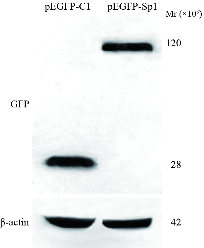 人GFP-Sp1基因真核表达载体的构建及其对细胞周期调控作用研究 人GFP-Sp1基因真核表达载体的构建及其对细胞周期调控作用研究