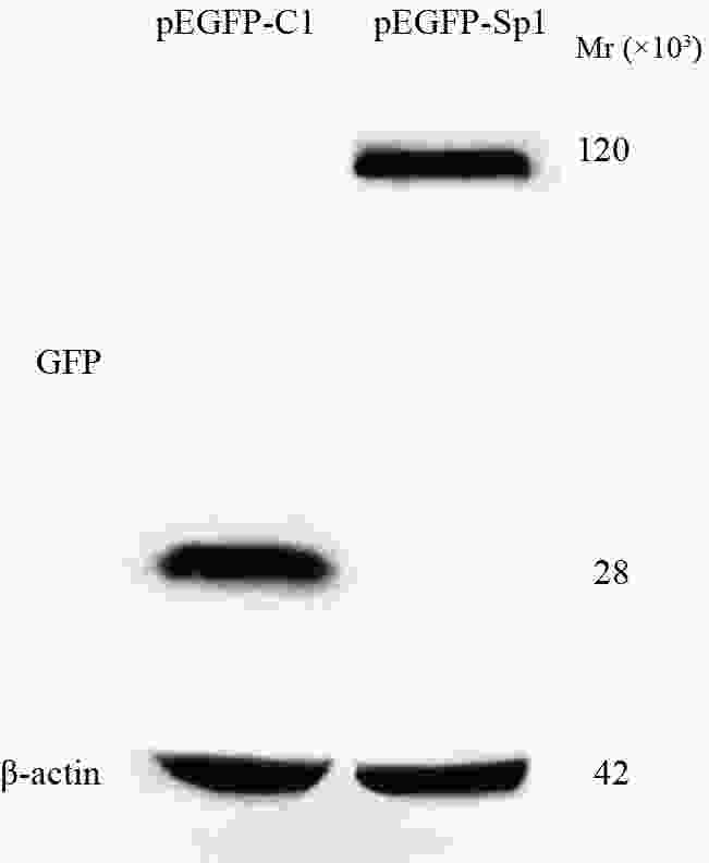 人GFP-Sp1基因真核表达载体的构建及其对细胞周期调控作用研究