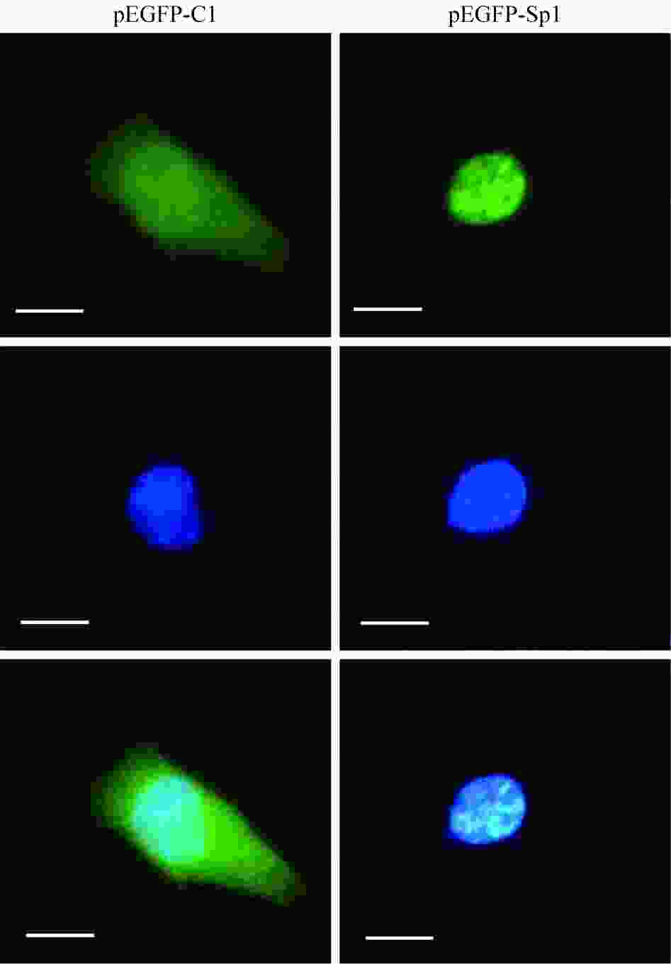 人GFP-Sp1基因真核表达载体的构建及其对细胞周期调控作用研究