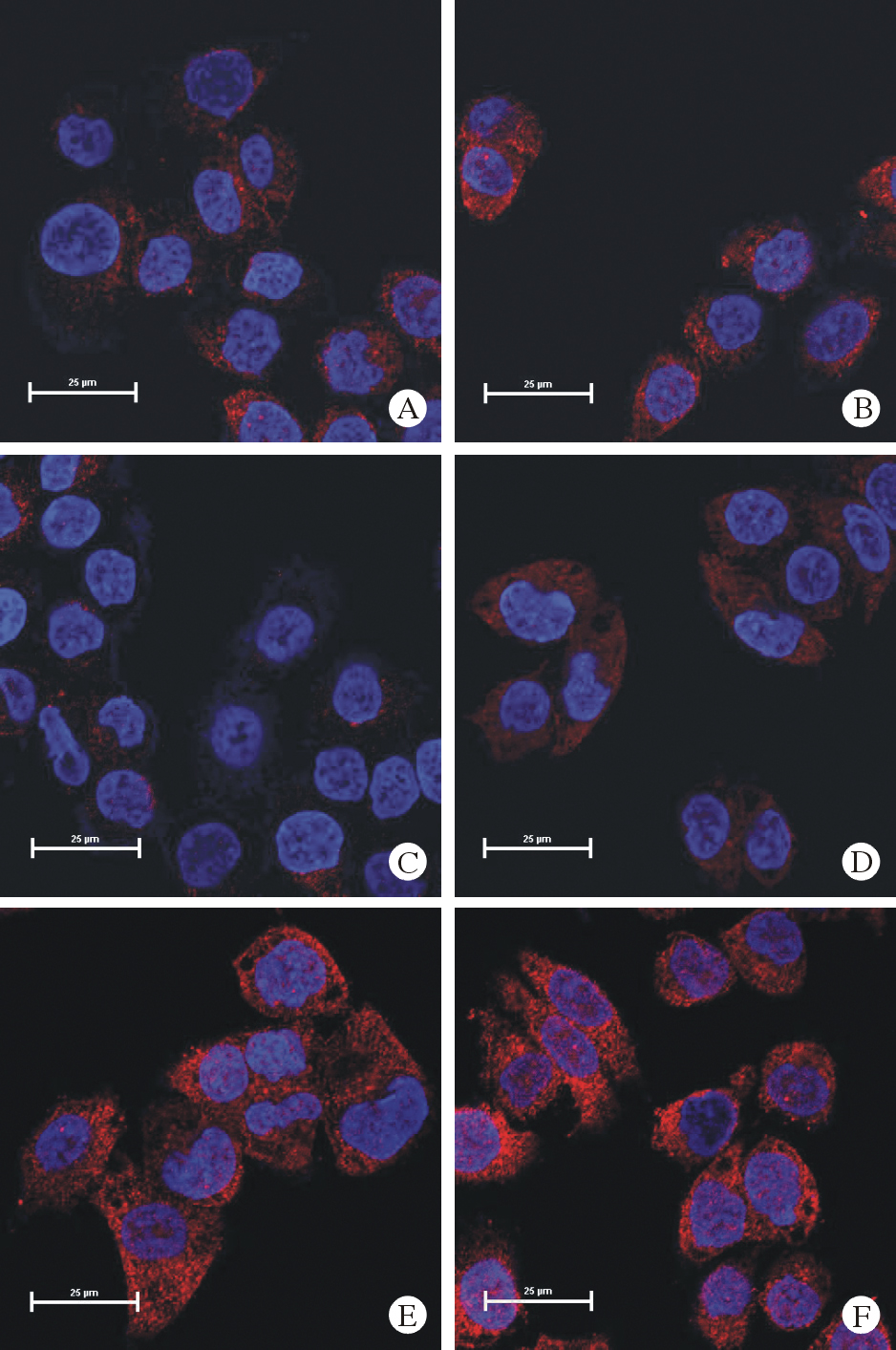 Effect of fluoride on osteoclast autophagy through the AKT/mTOR/ULK1 ...