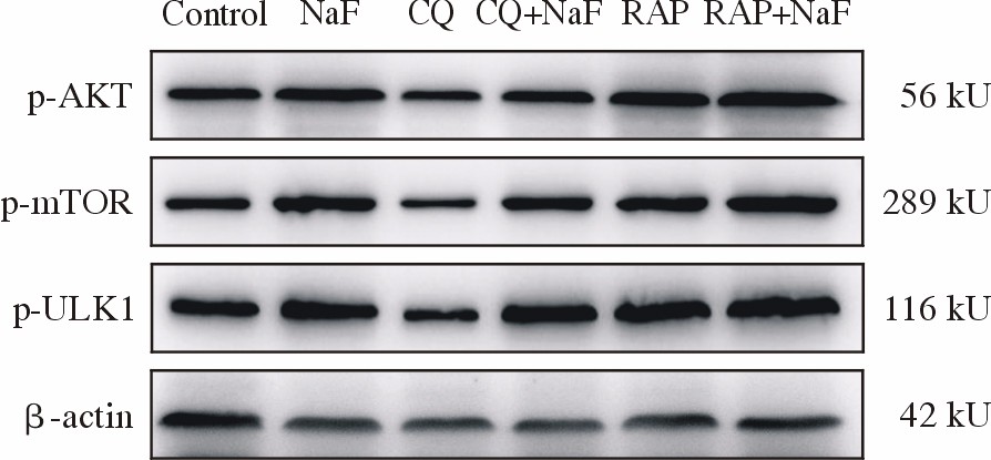 Effect of fluoride on osteoclast autophagy through the AKT/mTOR/ULK1 ...