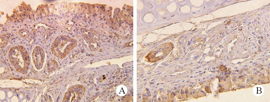 趋化因子受体6在过敏性鼻炎外周血和鼻黏膜中的表达及意义