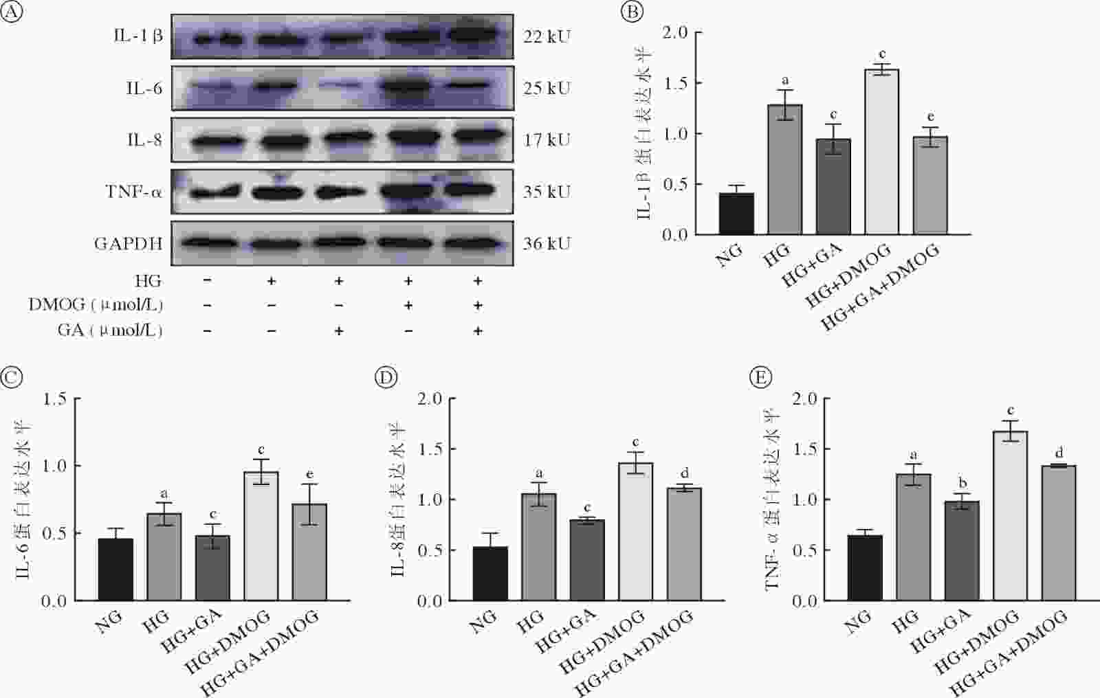 甘草酸通过下调缺氧诱导因子-1α抑制小鼠肾小球系膜细胞炎症因子的表达
